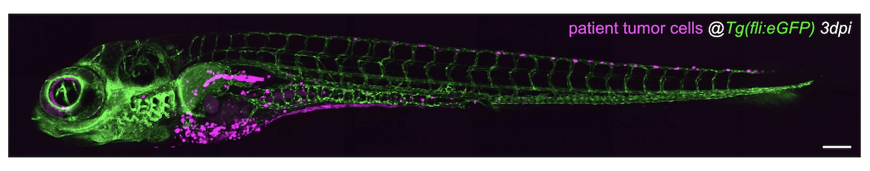 Fishing for Personalized Cancer Treatments – Chembites